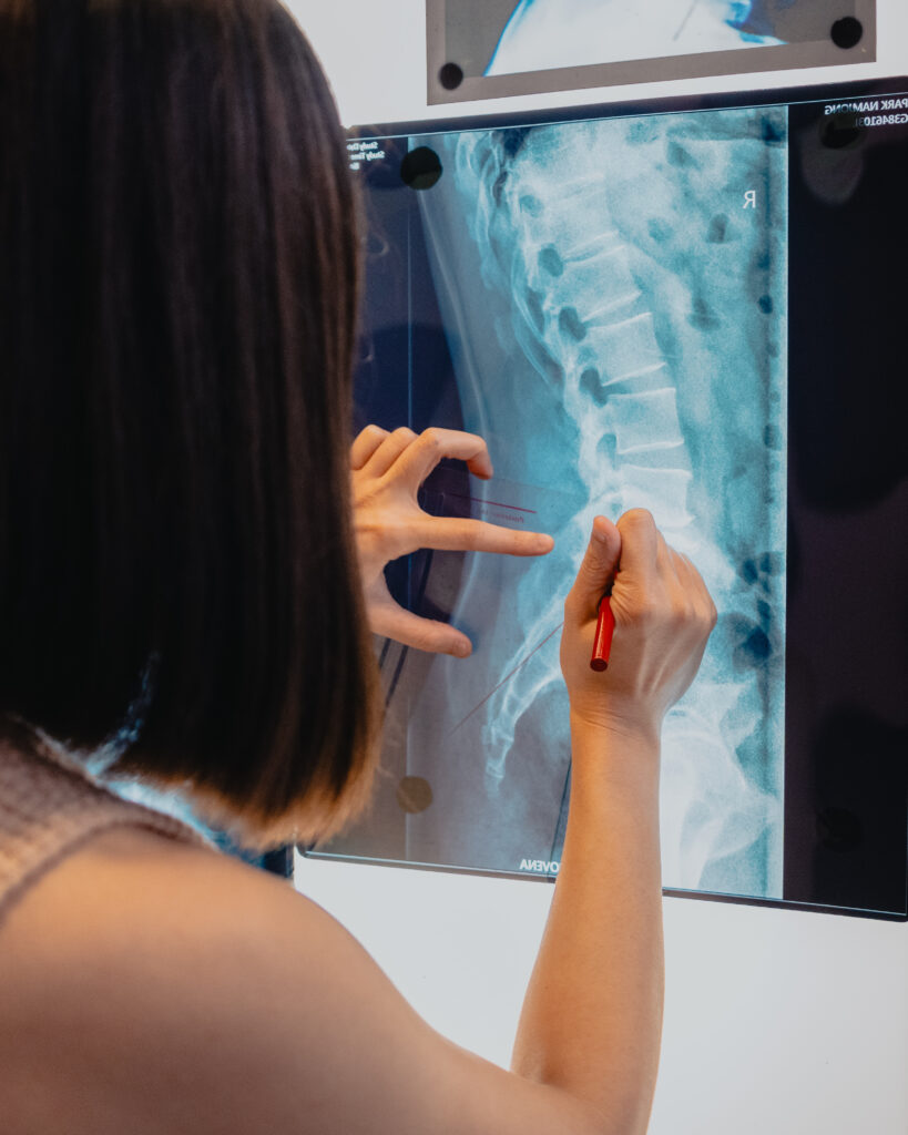 Spine corrector: The best posture correction method? | Chiropractic ...