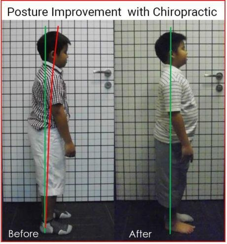 7 things to check for your child's bad posture | Chiropractic Singapore